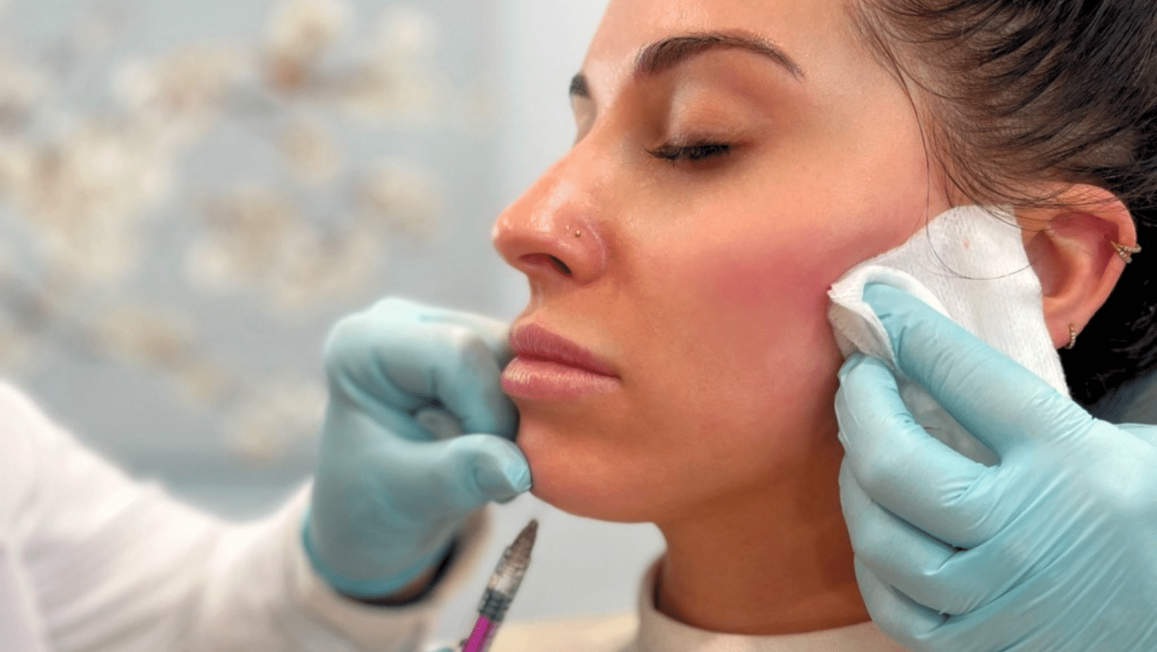 EMBRACE THE BEAUTY OF PREJUVENATION