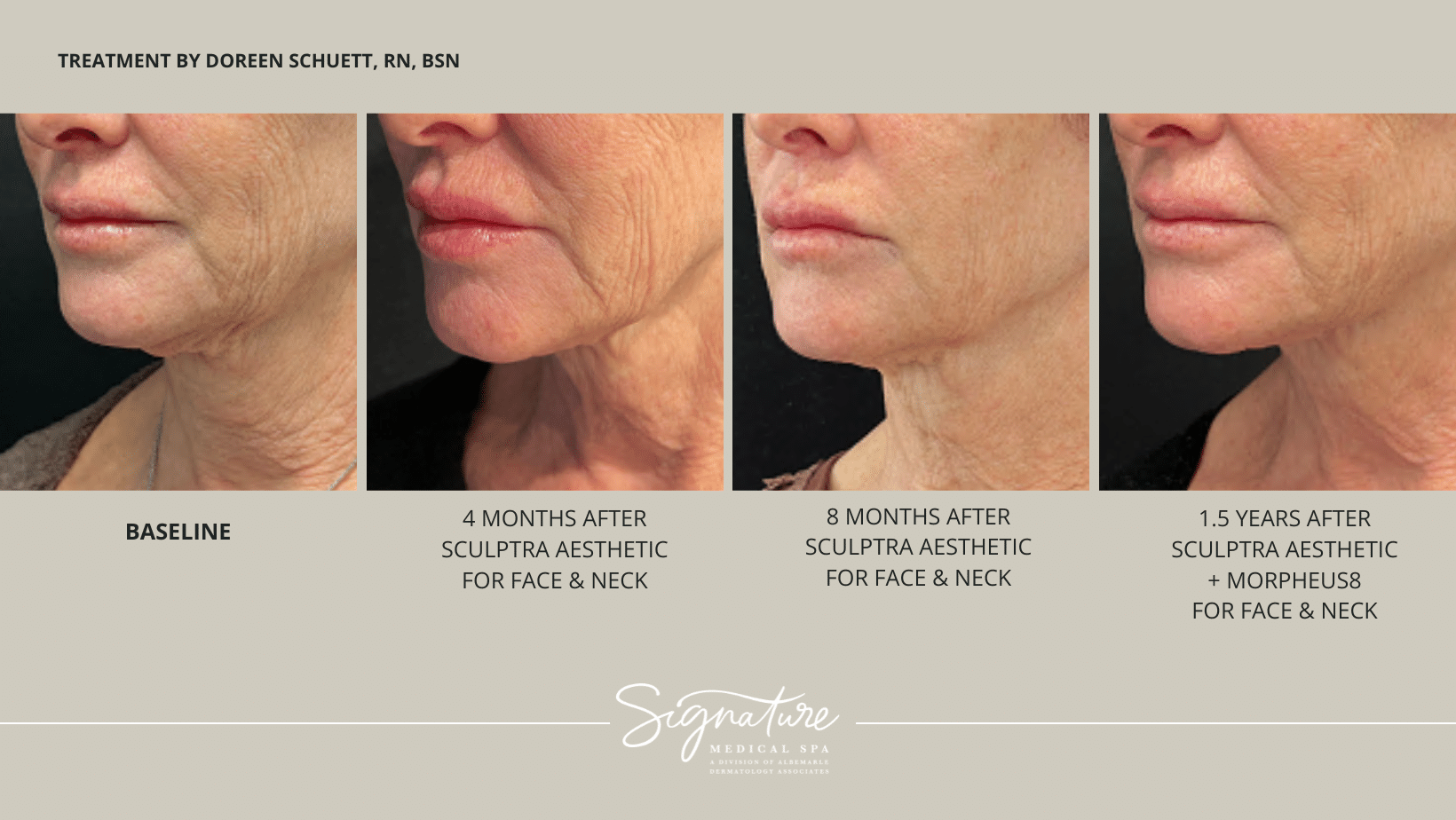 Neck Neglect No More - Restore Your Youthful Contour
